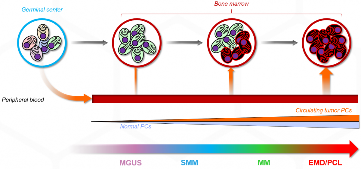 What Are Circulating Tumor Plasma Cells Cytognos S L